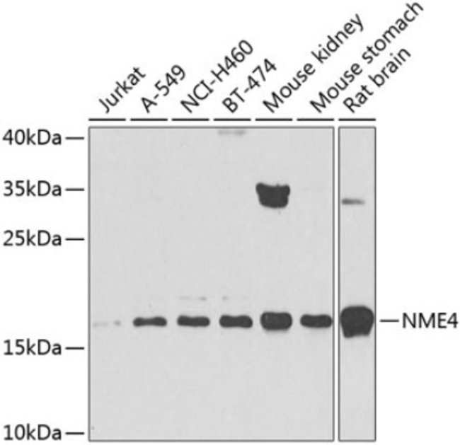 NME4 Rabbit anti-Human, Mouse, Rat, Polyclonal, Novus Biologicals:Antibodies:Primary | Fisher ...